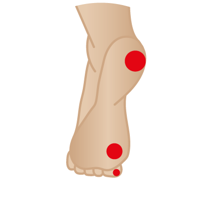 Unidad Láser Vascular Dermatológico - Centro Dermatológico Estético